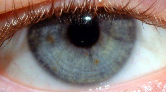 Fargeblindhet - NHI.no