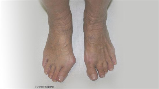 Bildequiz uke 51 - NHI.no