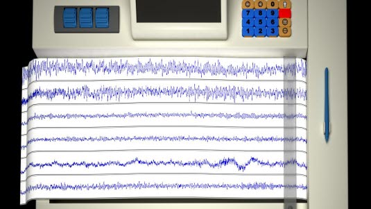 EEG - Hva er EEG? - NHI.no