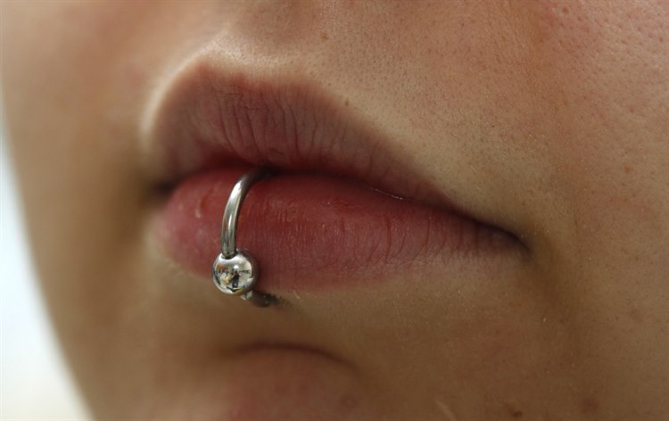 Leppe Piercing Infeksjon