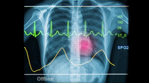 Hjertets elektriske system - NHI.no
