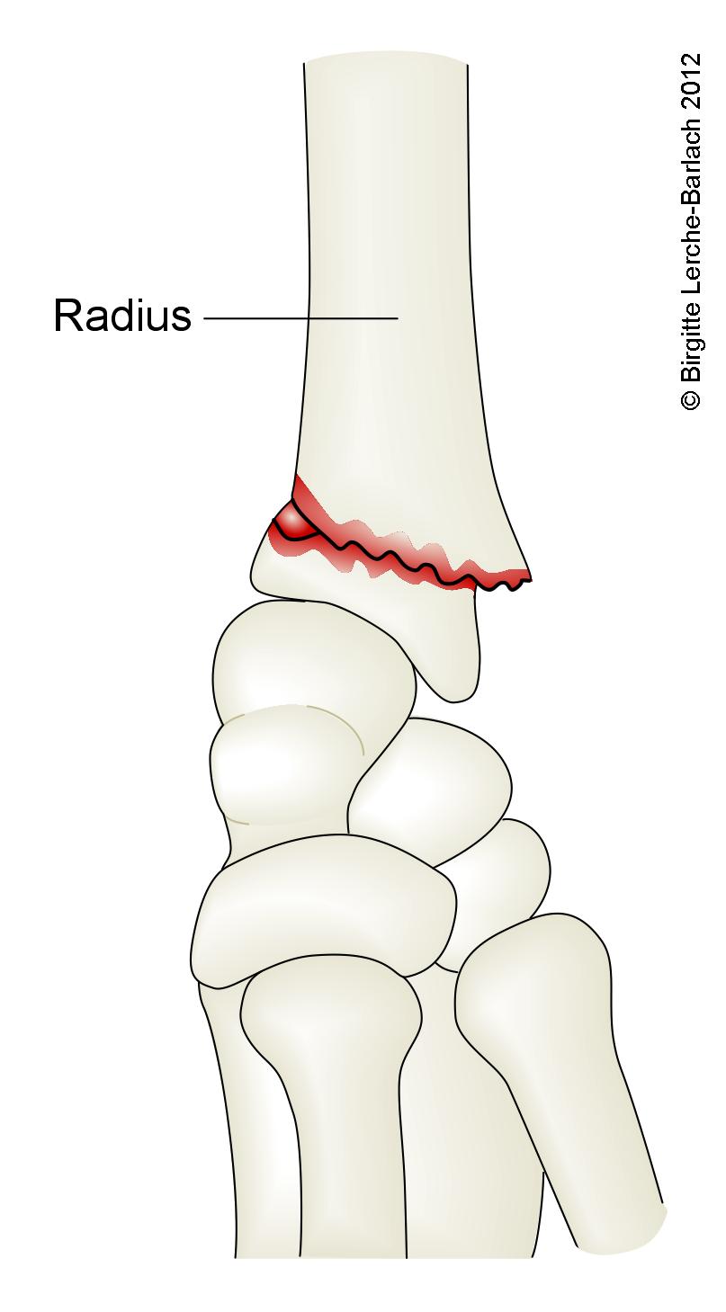 Røntgen av skjelettskader - NHI.no