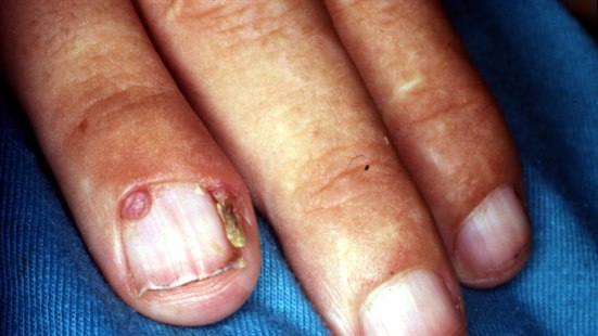 Bildequiz uke 48 2024 - NHI.no